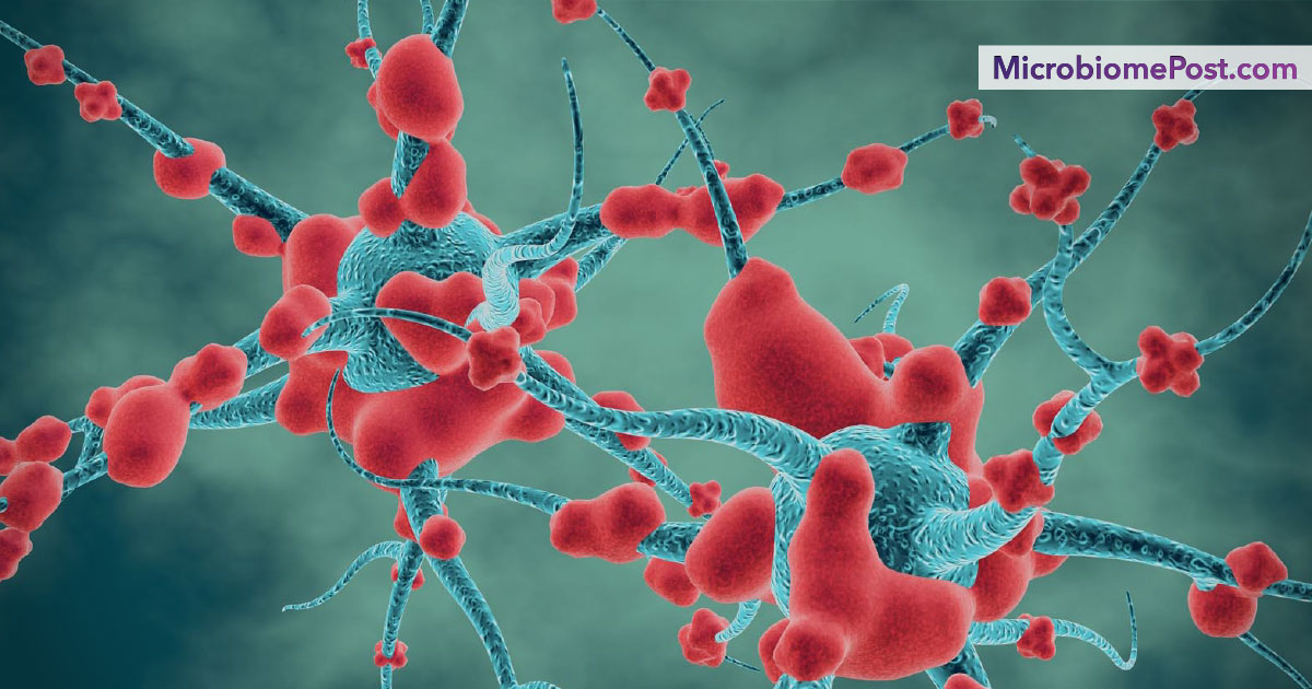 More clues link gut bacteria with multiple sclerosis