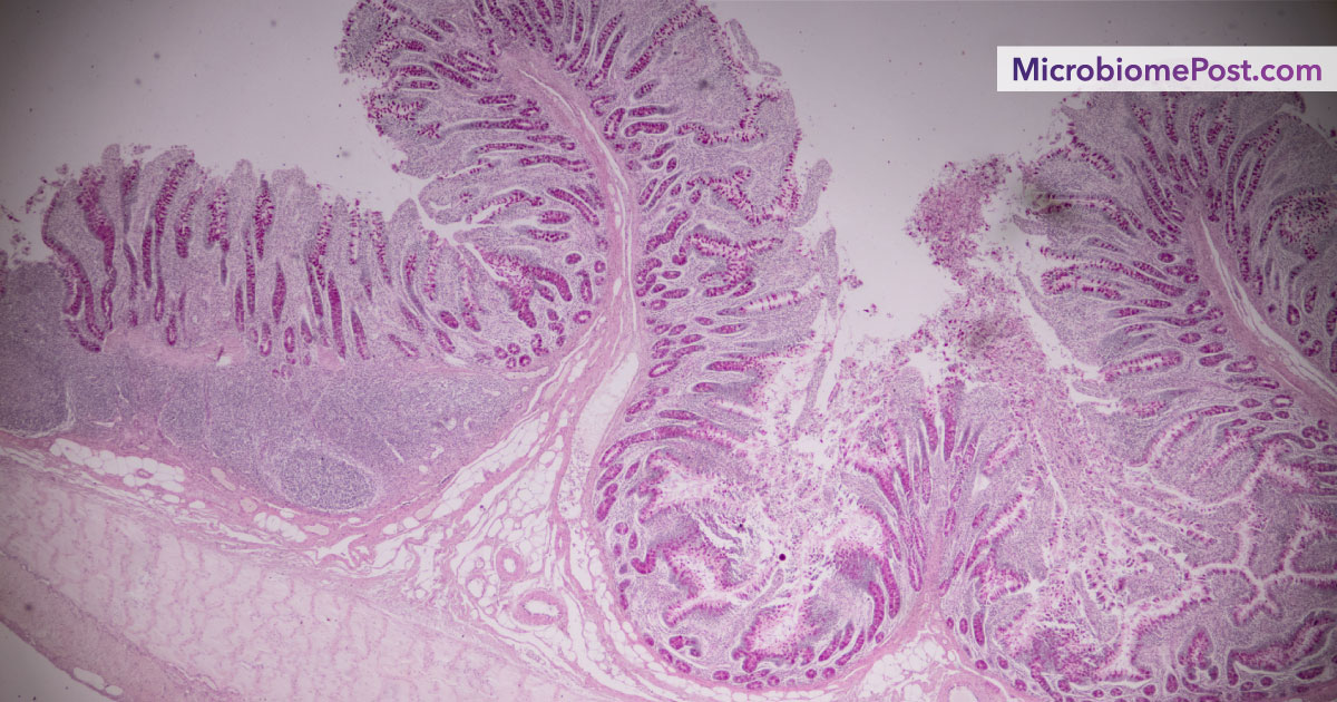 A better mouse model for inflammatory bowel disease