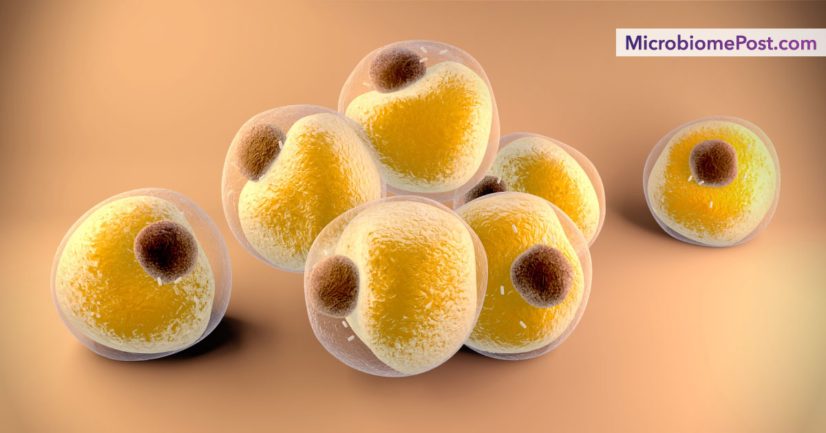 How gut microbes regulate fat tissue in obesity