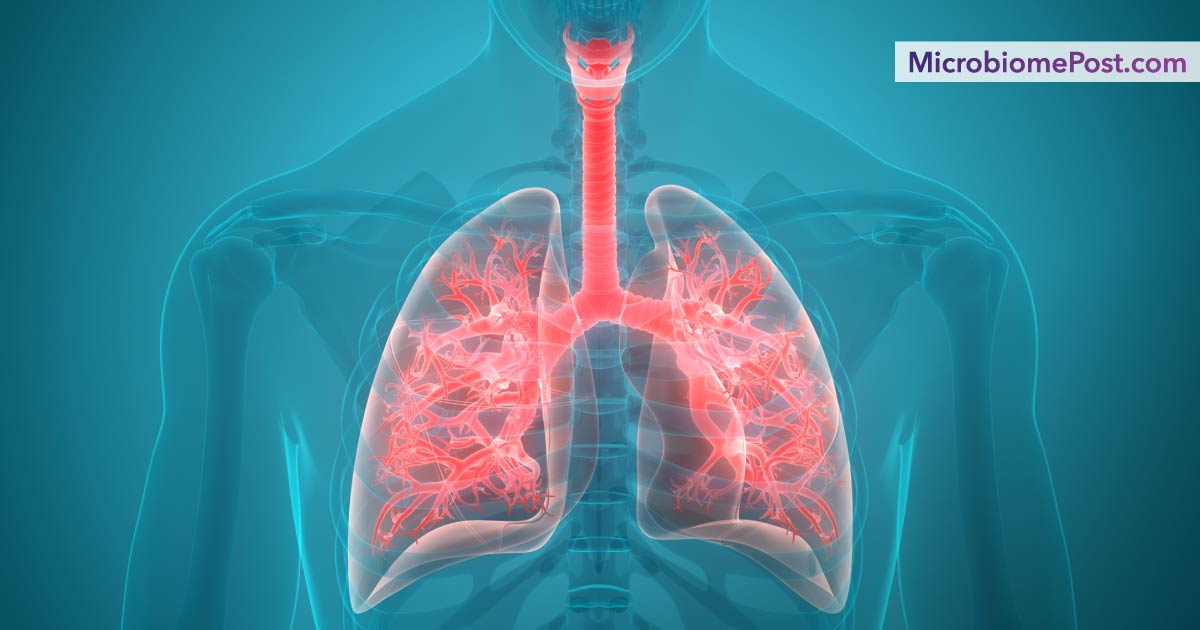 Lung bacteria could help to predict clinical outcomes in critically ill patients