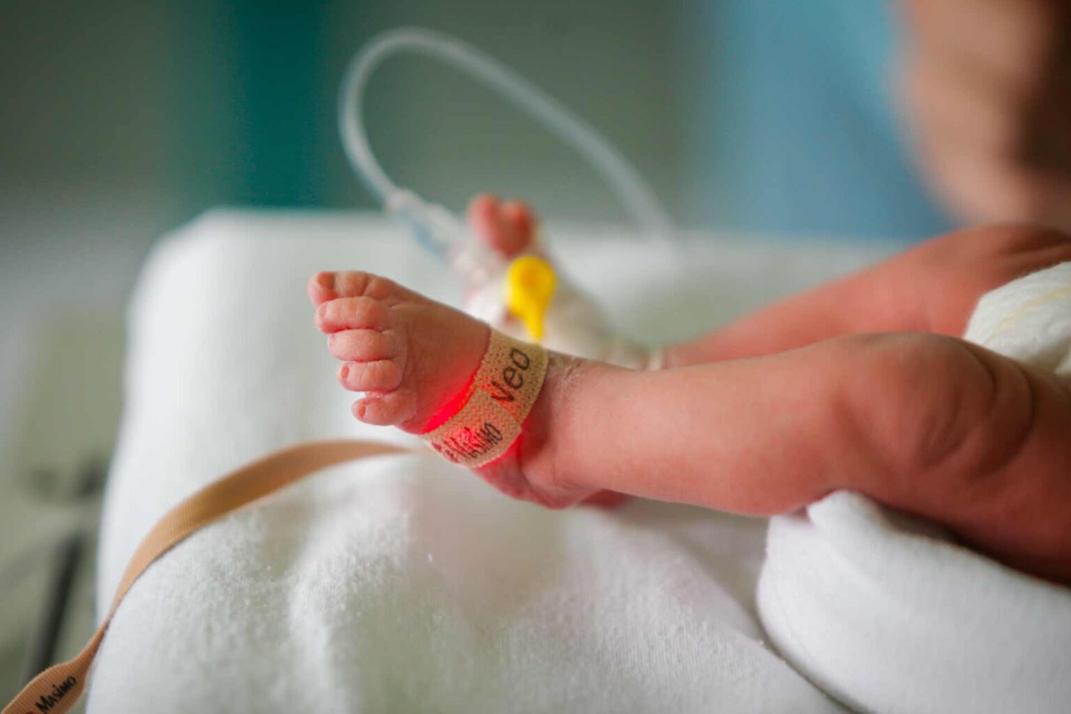 Gut microbes may worsen brain injury in preterm babies