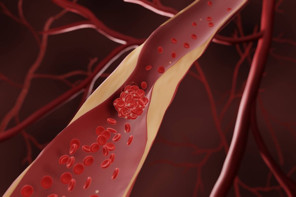 Gut microbiota and aging: state of the art